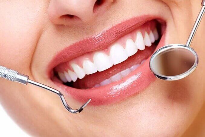 Smile Designing Kiwi Dental Hospitals and Dental Implants Center